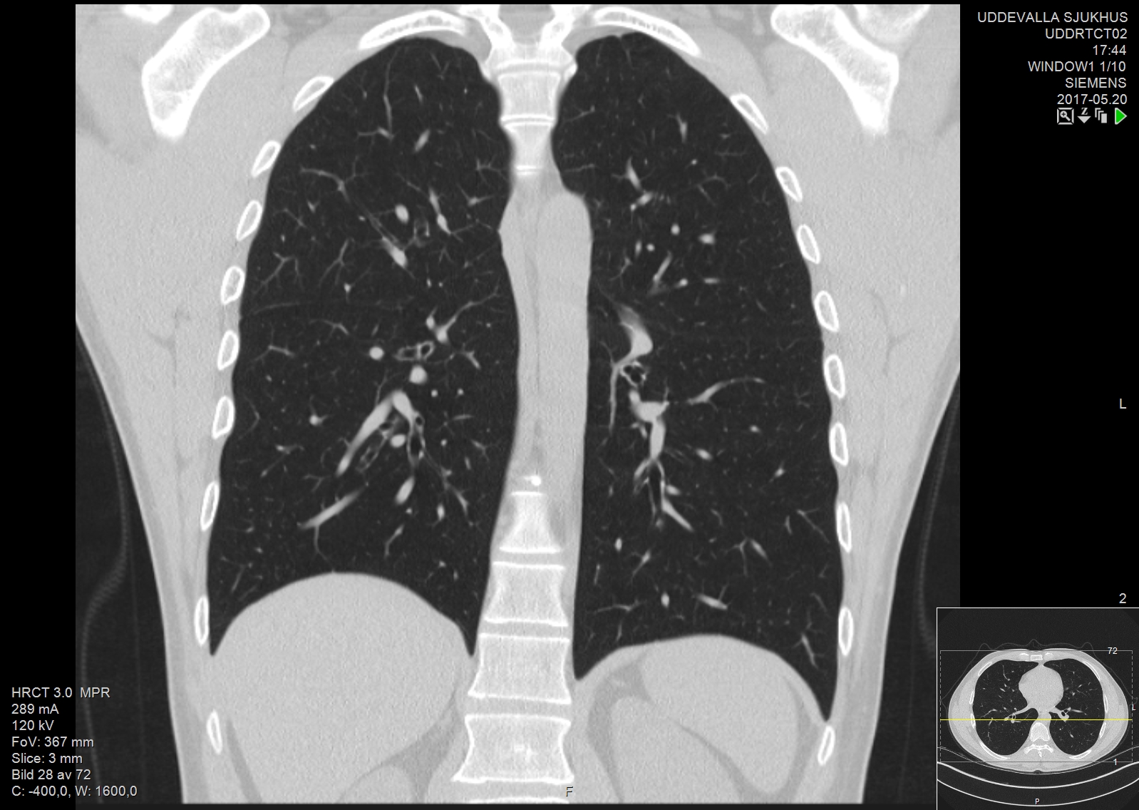 8 essentiële tips om je longen op natuurlijke wijze te zuiveren: wat je ...
